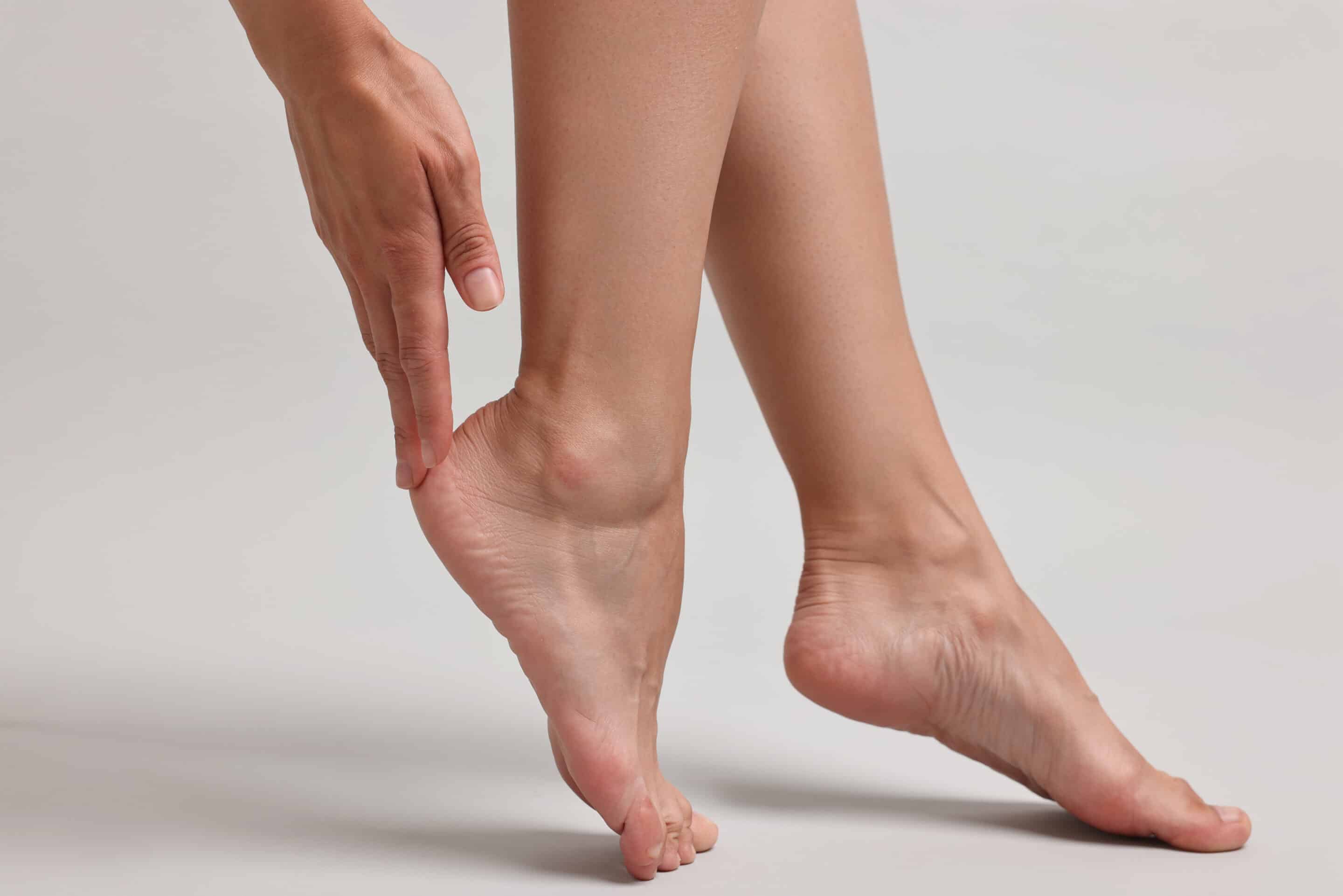 How to Cure Heel Pain Fast | Comprehensive Foot Centers